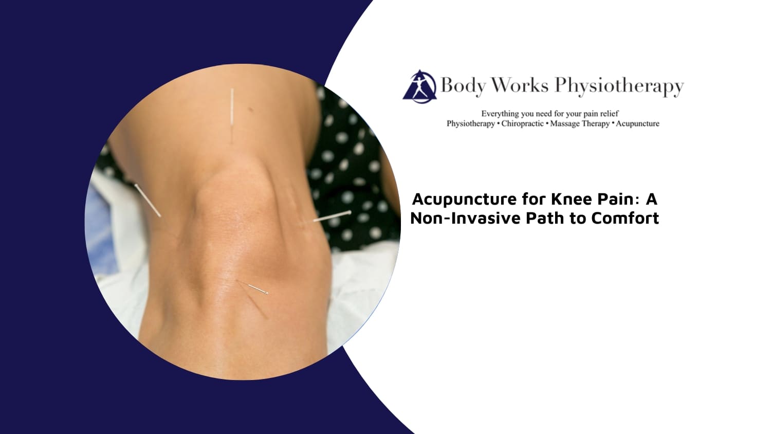 Acupuncture for Knee Pain: A Non-Invasive Path to Comfort