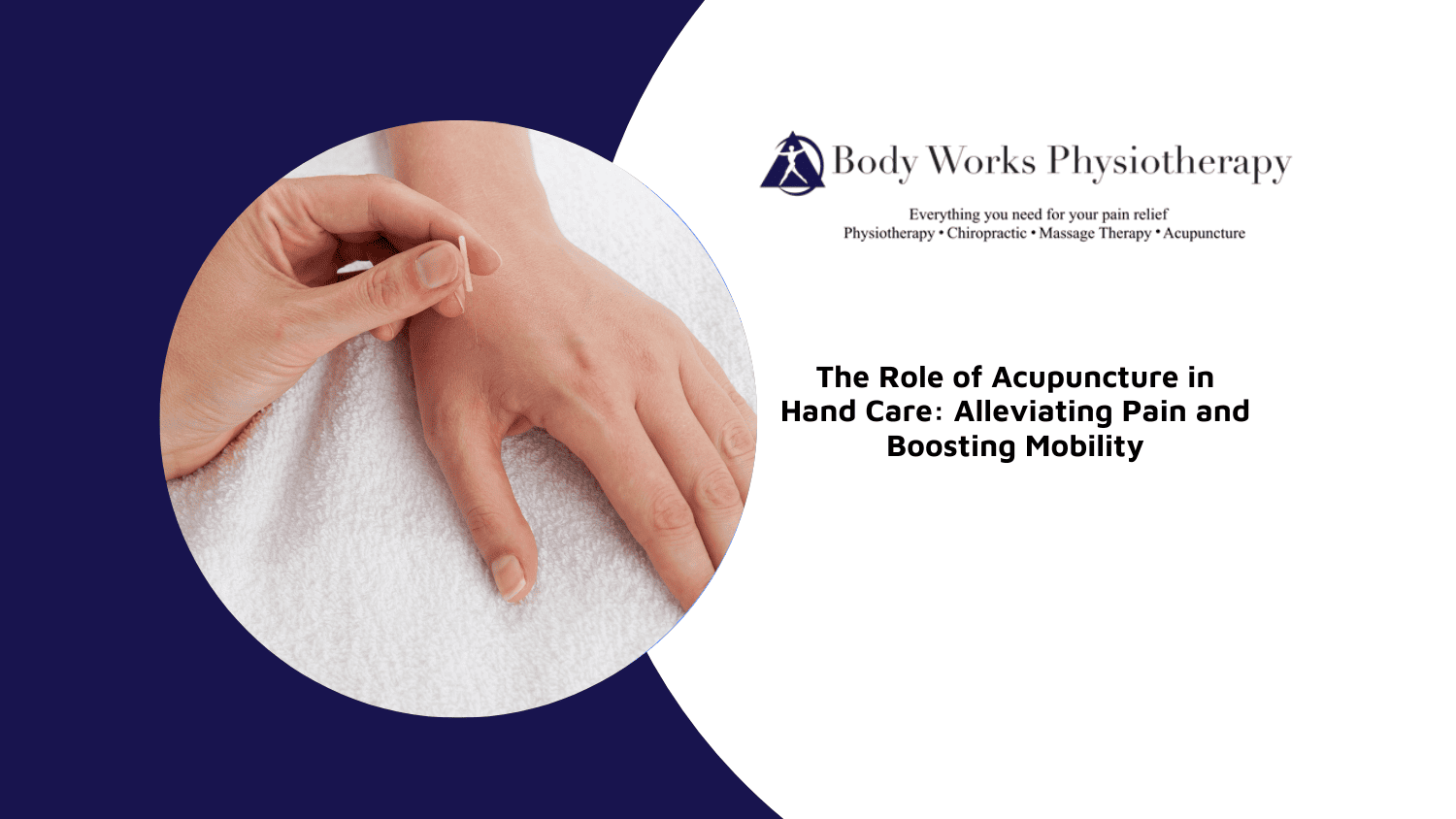 The Role of Acupuncture in Hand Care: Alleviating Pain and Boosting ...