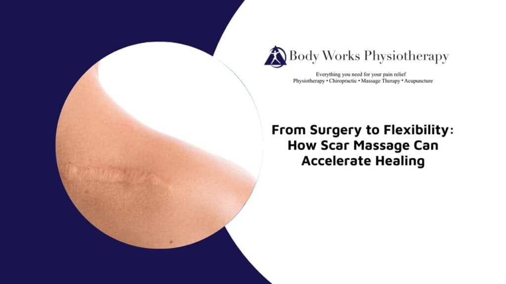 Healing Piriformis Syndrome: Expert Tips and Massage Therapy Insights
