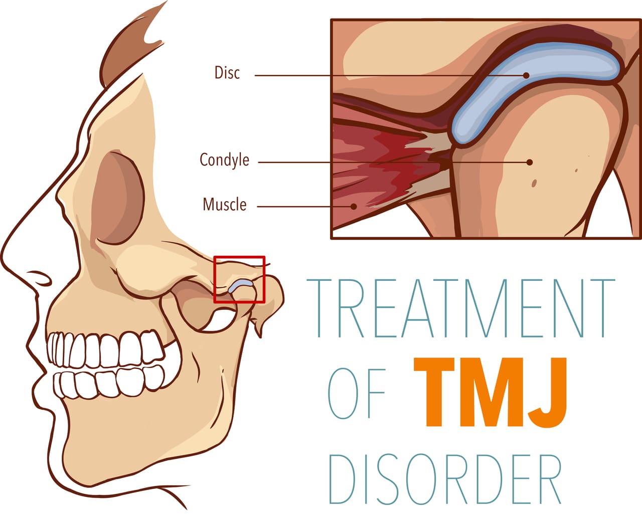 Massage Therapy for TMJ Pain: Natural Relief You Can Count On